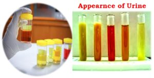 Physical Examination of Urine - MedicoInfo