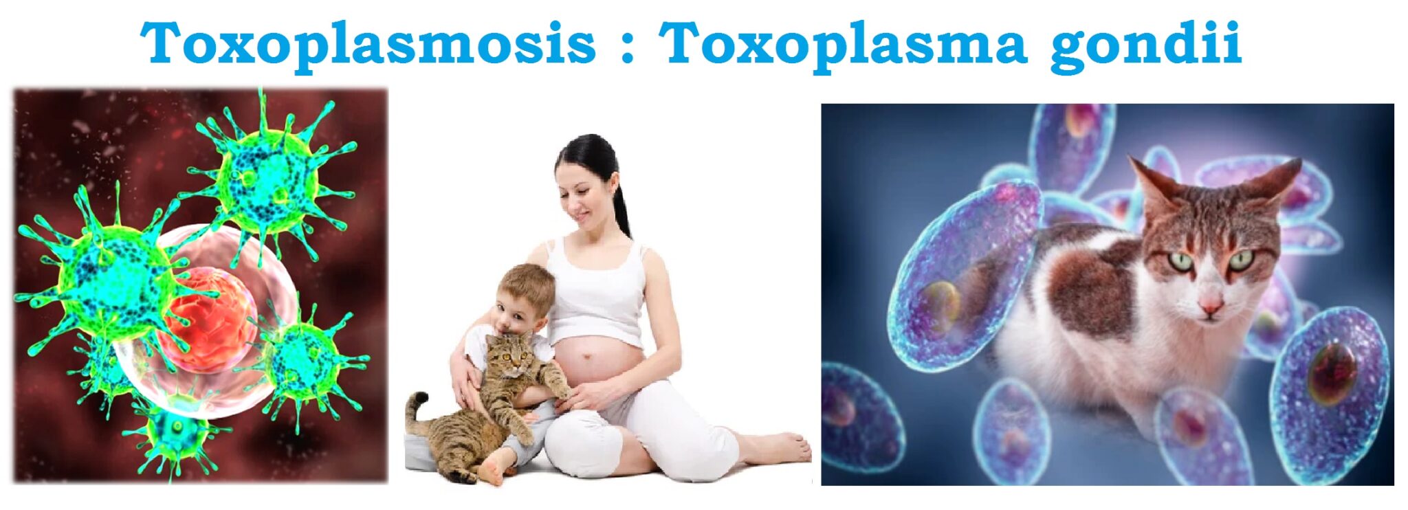Toxoplasmosis : Sign and Symptoms, Causes, Risk factors, Diagnosis, Complications, Treatment and ...