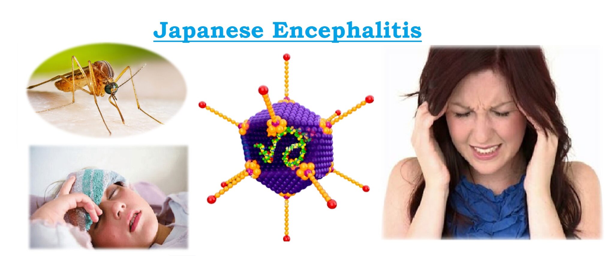 Japanese encephalitis (JE): Sign and Symptoms, Causes, Risk factors ...